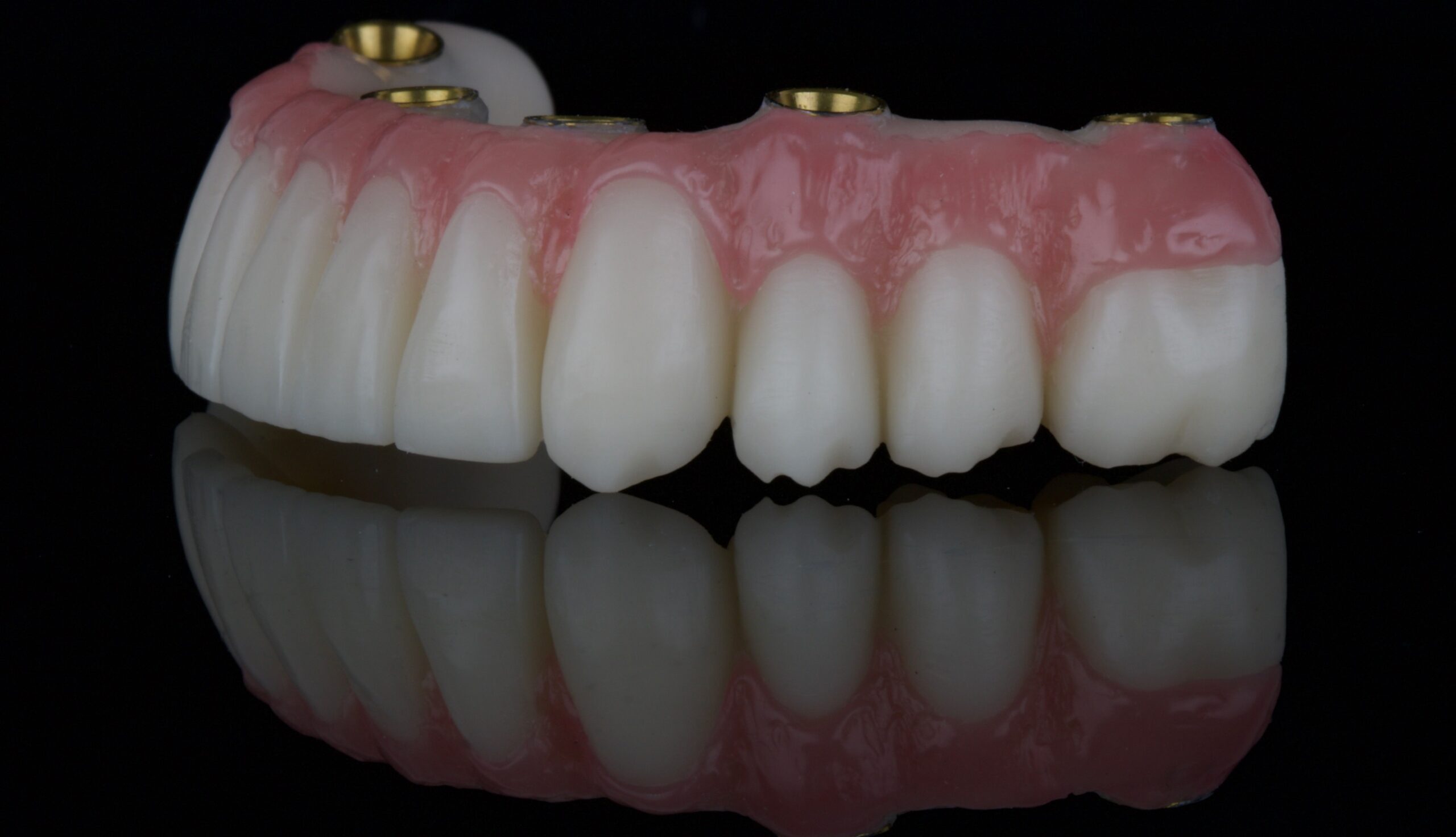 Provisionales – PMMA – Dental López